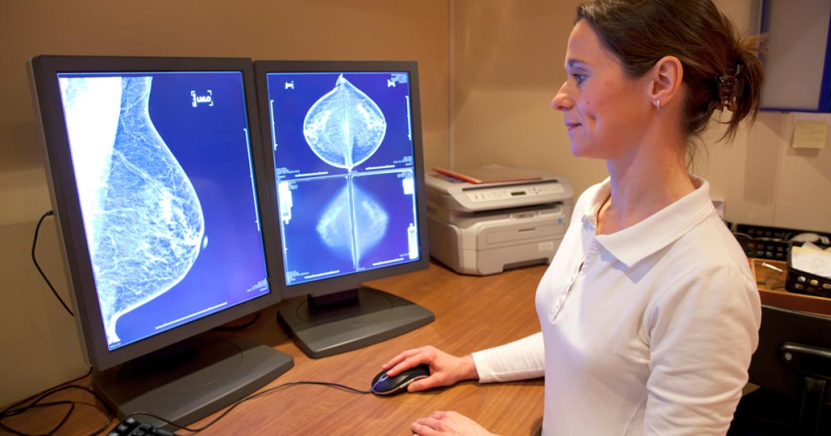 How does CAD-enhanced synthetic mammography compare to FFDM?