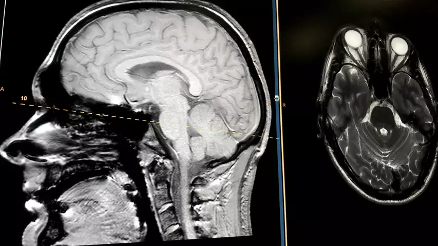 normal mri head