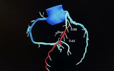 PHOTO GALLERY: Examples of FDA-cleared AI in radiology