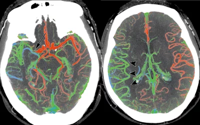 PHOTO GALLERY of brain imaging
