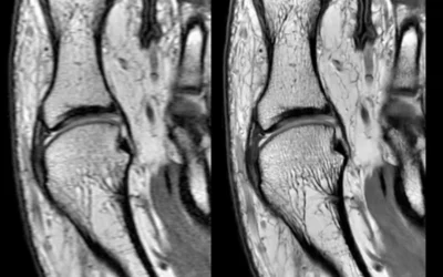 PHOTO GALLERY: Examples of FDA-cleared AI in radiology