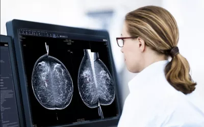 PHOTO GALLERY: What does breast cancer look like on mammography