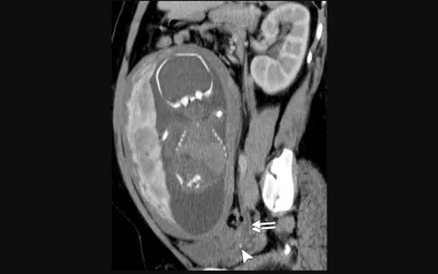 PHOTO GALLERY: What does fetal medical imaging look like?