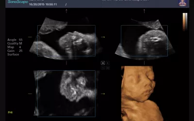 PHOTO GALLERY: What does fetal medical imaging look like?