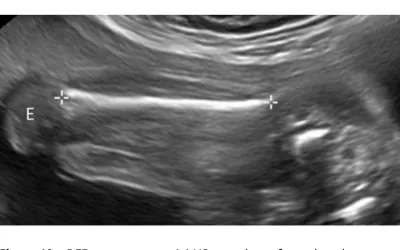 PHOTO GALLERY: What does fetal medical imaging look like?
