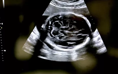 PHOTO GALLERY: What does fetal medical imaging look like?