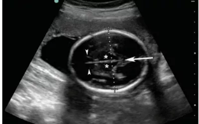 PHOTO GALLERY: What does fetal medical imaging look like?