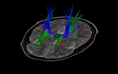 PHOTO GALLERY of brain imaging