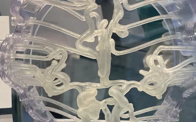 PHOTO GALLERY of brain imaging