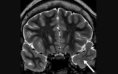 PHOTO GALLERY of brain imaging