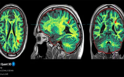 PHOTO GALLERY of brain imaging
