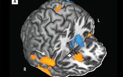 PHOTO GALLERY of brain imaging