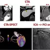 comparison_cta_vs_angiography_2022_cad_guidelines_image.jpg | Radiology ...
