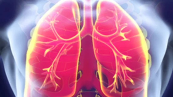 FDG-PET/CT radiomic features improves lung cancer care