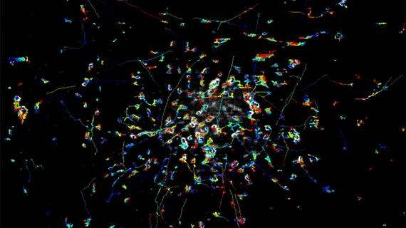 NIH merges microscopes to generate clearer images of processes inside cells