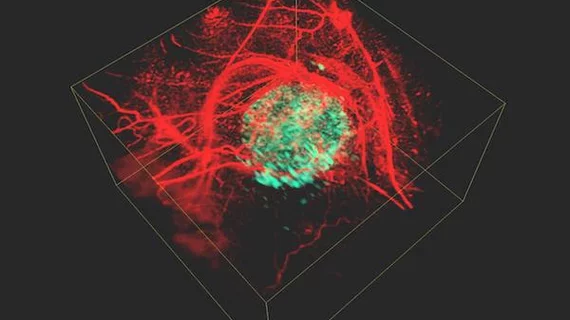 New photoacoustic imaging method offers 3D look at cancer cells