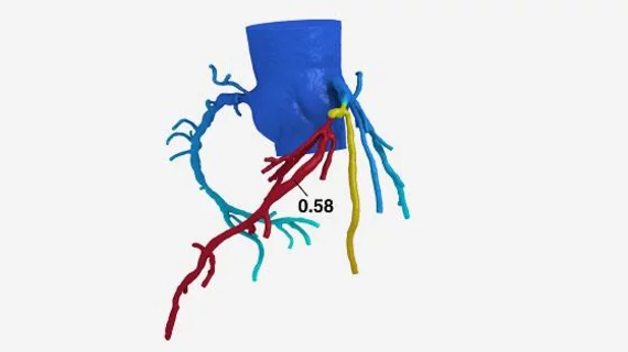 Experts debate clinical impact of HeartFlow's noninvasive cardiac imaging