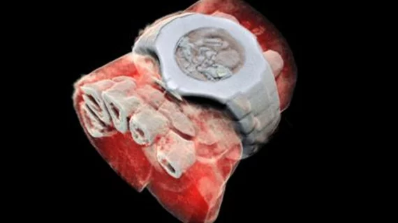 First human imaged with novel 3D color x-ray scanner in New Zealand