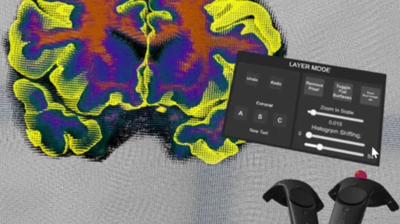 VR tool could enhance medical imaging segmentation, error correction