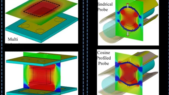 Simple antenna radio probe can improve MRI resolution