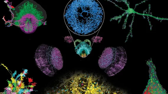 Novel microscopy method enables high-resolution study of neural brain circuits