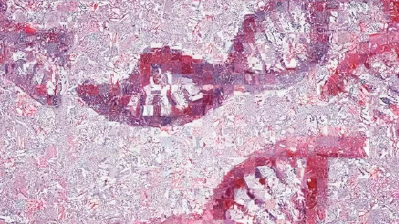 ‘Revolutionary’ AI-powered digital pathology algorithm customizes ...