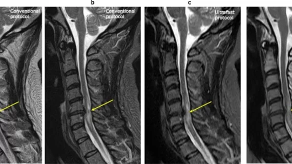 Ultrafast MRI protocol reduces scan time by 10 minutes for cervical imaging