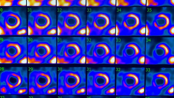 Cardiac PET | Radiology Business