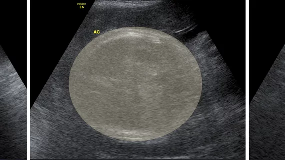 BabyNet AI model predicts fetal birth weight