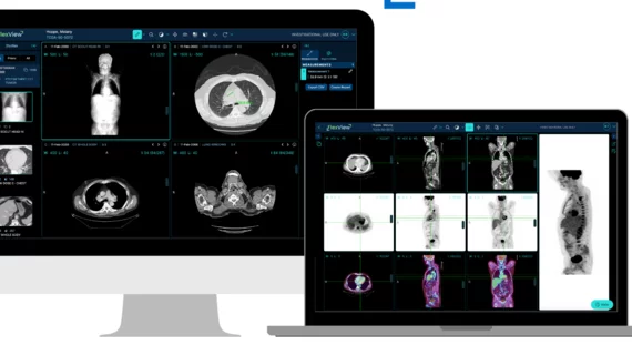 Integration moves radiology image viewing and analysis onto single platform