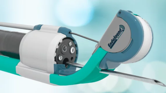 FDA clears 'first-of-kind' ultrasound technology