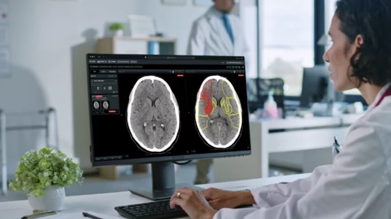 AI software triples number of stroke patients who achieve functional ...