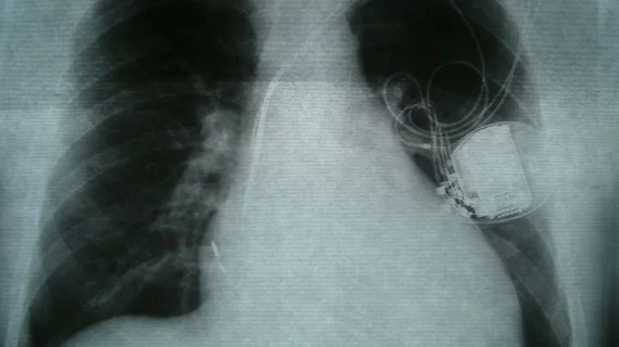 Cardiac implantable electronic devices can be safely reprogrammed to ...