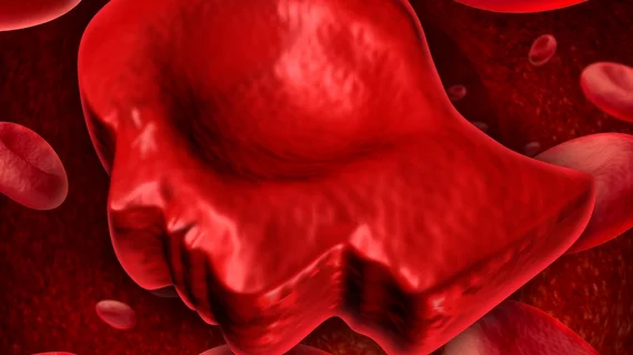 Medtronic, Viz.ai partner on AI-powered stroke detection